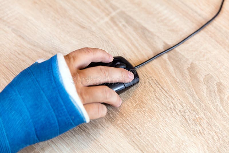 Arm with cast stock photo. Image of office, human, health - 73681352