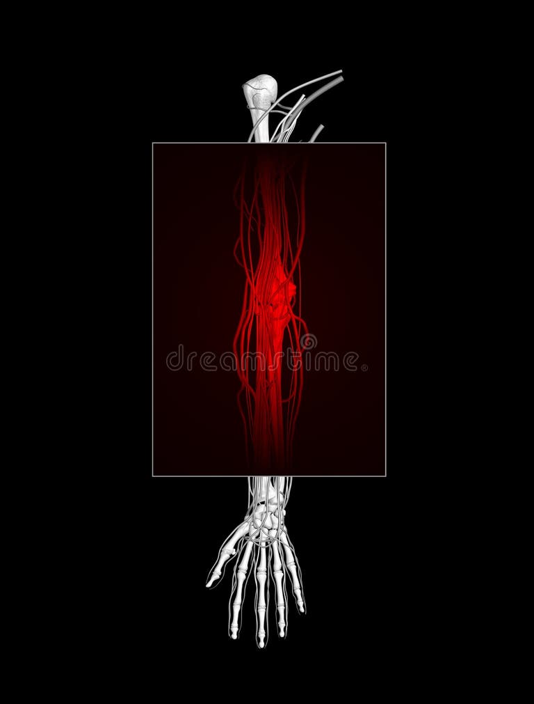 Arm Veins Stock Illustrations – 1,681 Arm Veins Stock Illustrations ...