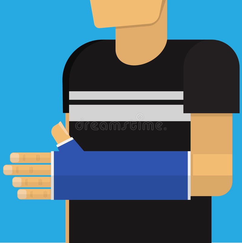 Splint Stock Illustrations – 574 Splint Stock Illustrations, Vectors ...