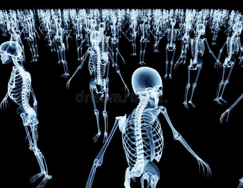 Army Xray Skeletons Isolated Black Stock Illustrations – 4 Army Xray ...