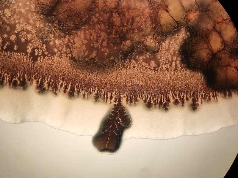 The Art of Bacteria Microscope View of Bacillus and Other Bacteria ...