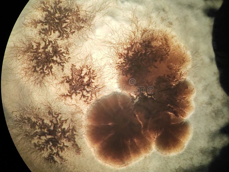 The Art of Bacteria Microscope View of Bacillus and Other Bacteria ...