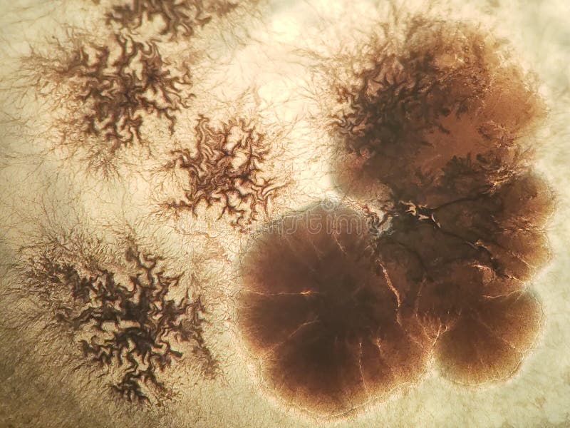 The Art of Bacteria Microscope View of Bacillus and Other Bacteria ...