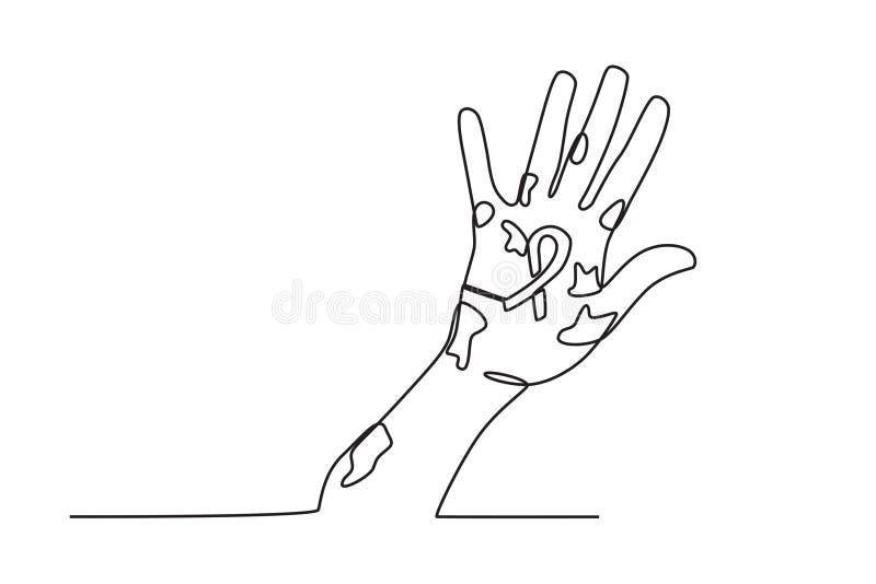 A Leper S Hand Holding a Ribbon Stock Vector - Illustration of disorder ...