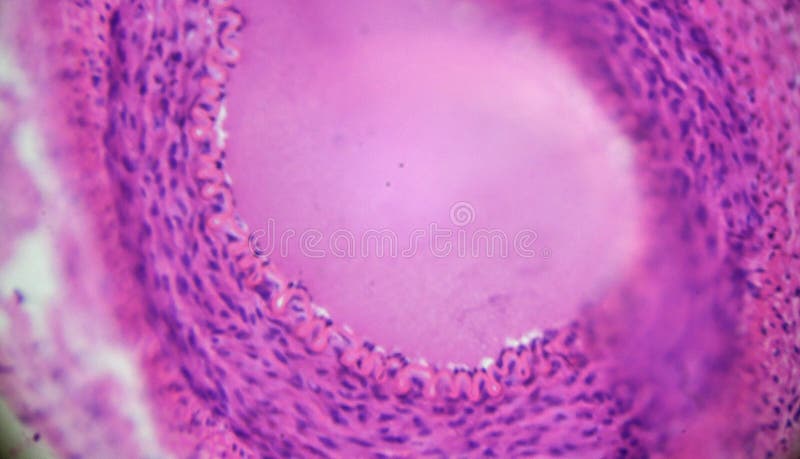 Vein Valves Stock Photos - Free & Royalty-Free Stock Photos from Dreamstime