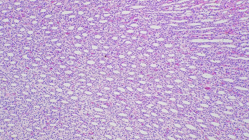 Section Of Artery Magnified Under Microscope 100x And Filmed With Oblique Illumination Stock