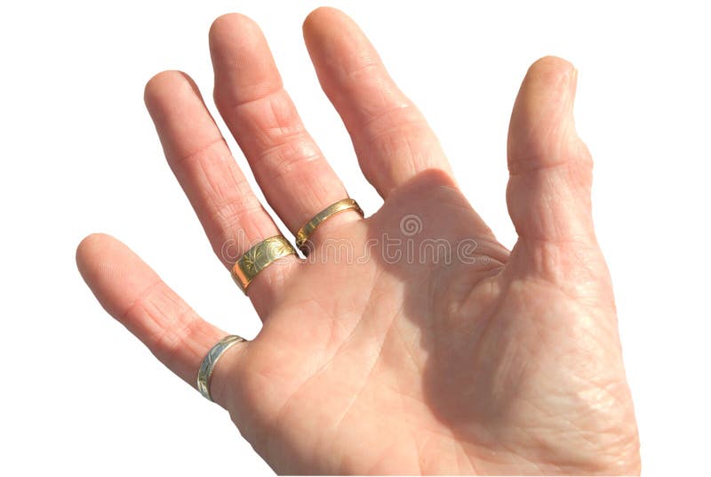 Arthrite Chez La Main De La Femme Photo stock - Image du pouce ...