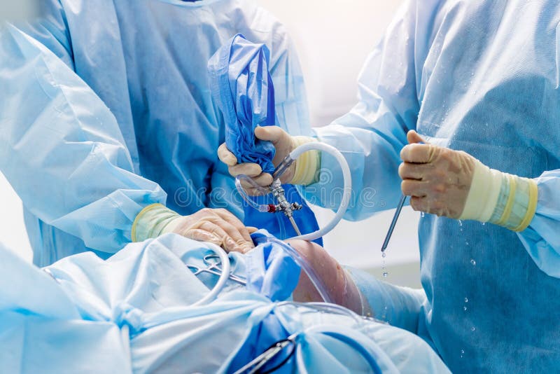 Arthroscope Surgery. Orthopedic Surgeons in Teamwork in the Operating ...