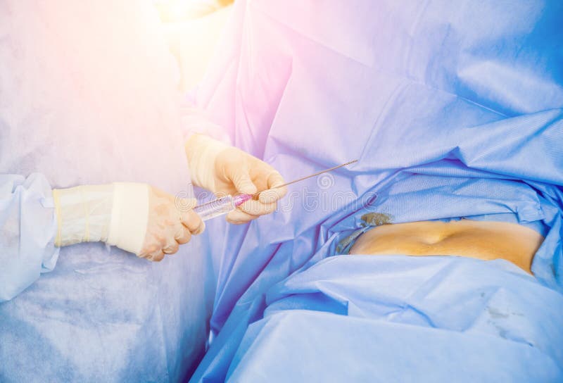 Arthroscope Surgery. Orthopedic Surgeons in Teamwork in the Operating ...