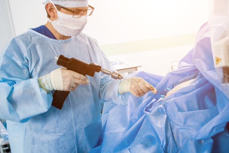 Arthroscope Surgery. Orthopedic Surgeons in Teamwork in the Operating ...