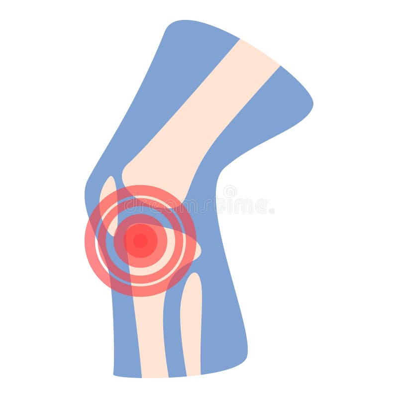 Treatment Articulation Stock Illustrations – 343 Treatment Articulation ...