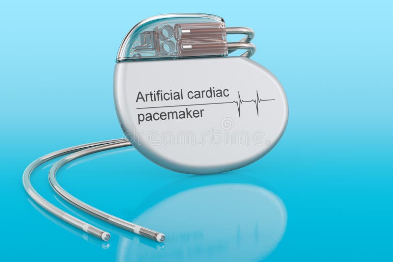 Artificial Cardiac Pacemaker on Blue Background, 3D Rendering Stock ...