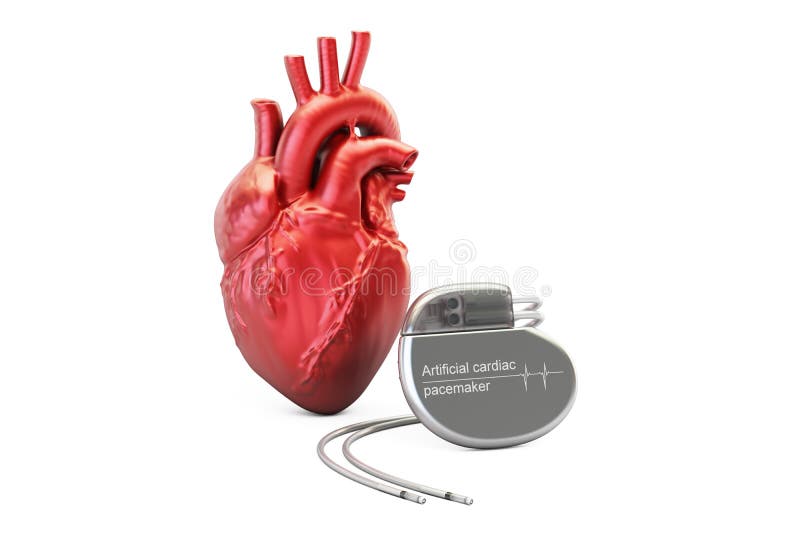 Artificial Cardiac Pacemaker, 3D Rendering Stock Illustration ...