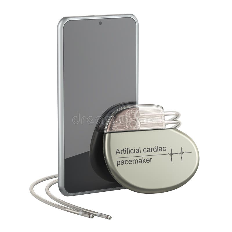 Pacemaker Stock Illustrations – 1,695 Pacemaker Stock Illustrations ...