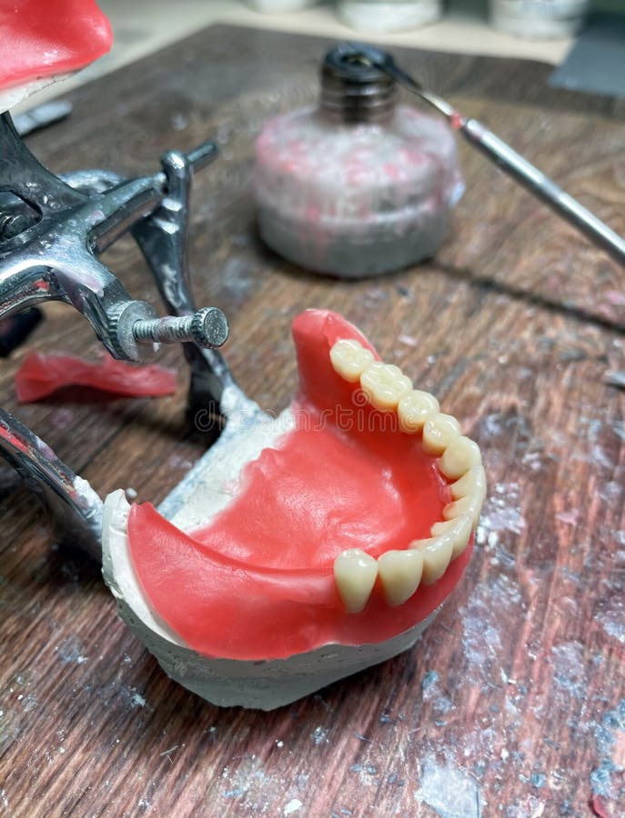 Artificial Dentures in the Manufacturing Steps in the Dental Lab ...