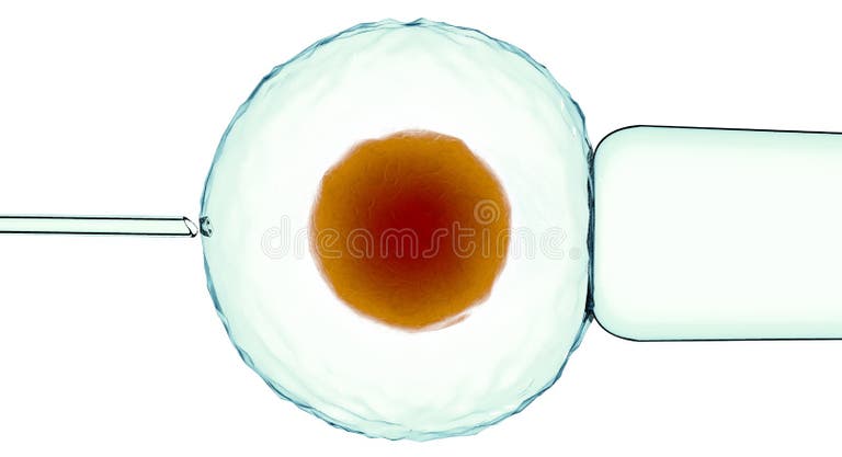 Artificial Fertilization, Assisted. Fertilized Cell, Ovum. Artificial ...