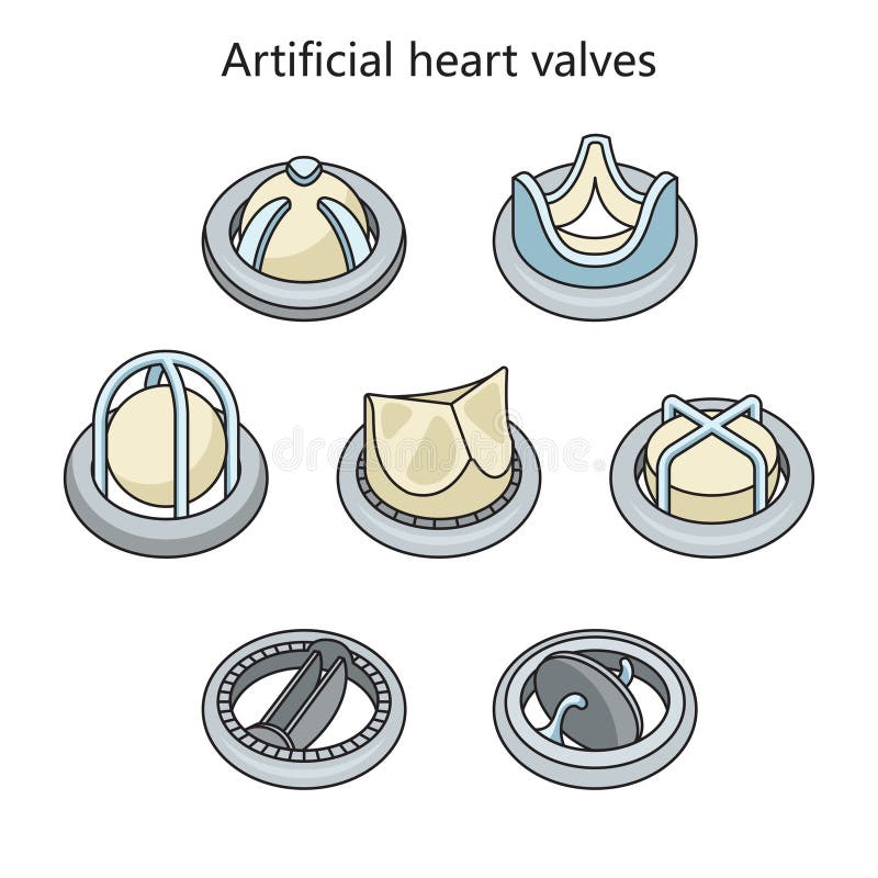 Artificial Heart Valves Medical Science Stock Illustration ... Artificial Heart Valves Medical Science Stock Illustration ...