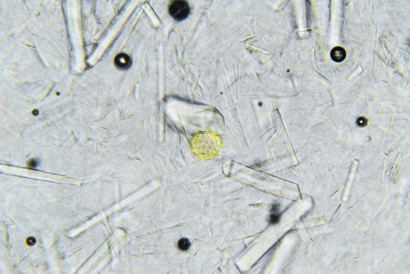 Artificial Honey with Large Rectangular Sugar Crystals Under Microscope ...