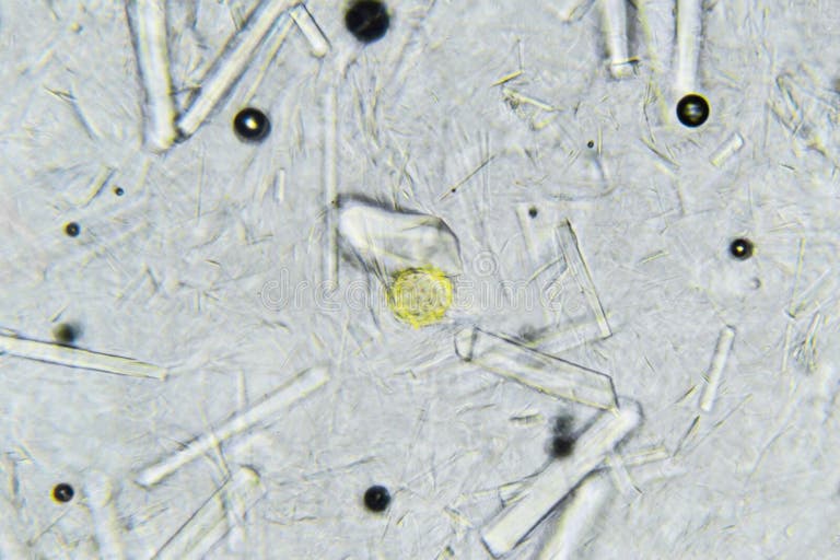 Sugar Crystals Under Microscope Stock Photos - Free & Royalty-Free ...