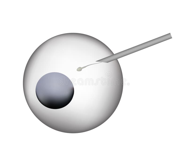 Artificial Insemination Injecting Sperm into Female Egg Cell Stock ...