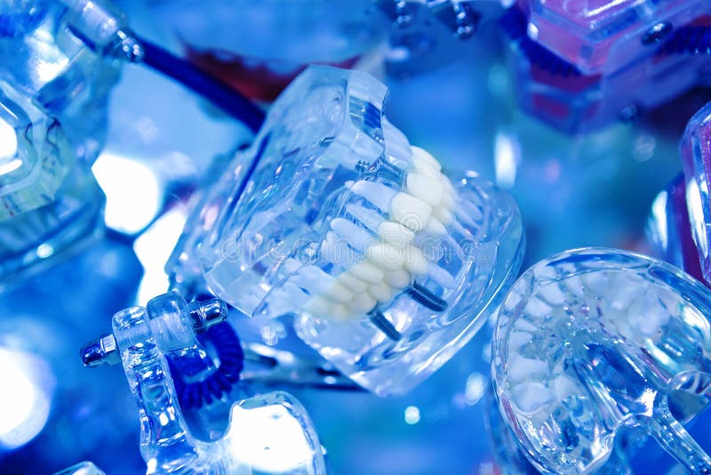 Dental Simulator for Teeth Alignment . the Child Has Mouth Guards on ...