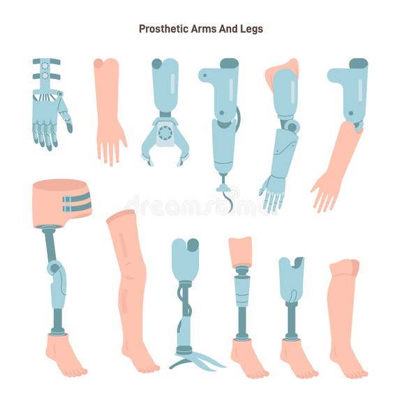 Prosthesis Types Stock Illustrations – 40 Prosthesis Types Stock ...