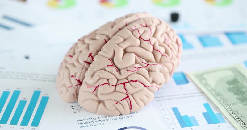Artificial Model of Human Brain Lying on Documents with Graphs Closeup ...