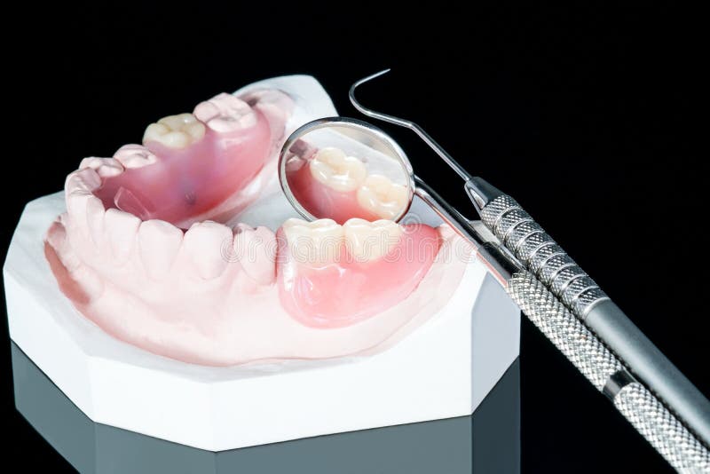 Artificial Removable Partial Denture. Stock Photo - Image of closeup ...