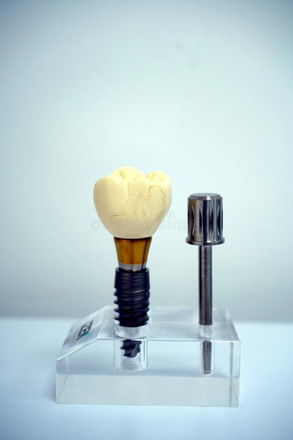 Artificial tooth insert. stock image. Image of yellow - 373624995
