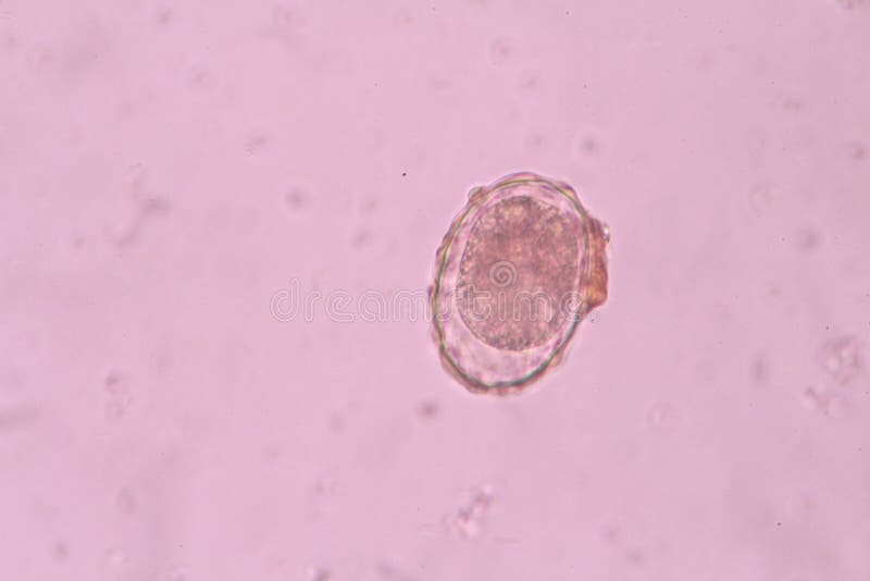 Ei Von Ascarid Lumbricoides (Spulwurm) Stockfoto - Bild von protozoen ...