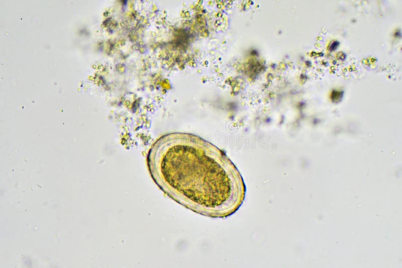 Ei Von Ascarid Lumbricoides Spulwurm Stockbild - Bild von prüfung ...