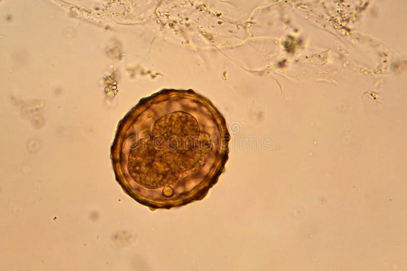 1,196 Roundworm Stock Photos - Free & Royalty-Free Stock Photos from ...