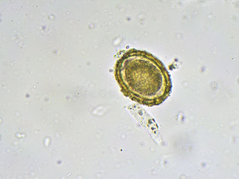 Ascaris lumbricoides stock photo. Image of infection - 93433054