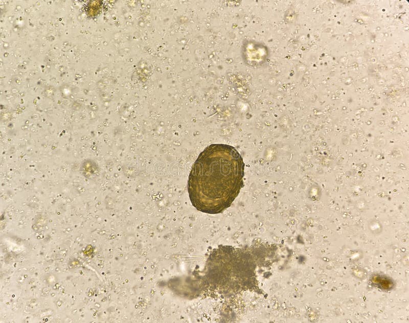 Ascaris lumbricoides stock foto. Image of microscopisch - 270416344