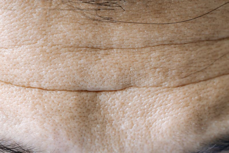 Asian Face Skin Problems stock photo. Image of beautiful - 158377174