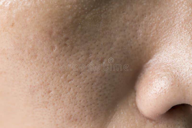 Asian Face, Skin Problems stock photo. Image of portrait - 158377180