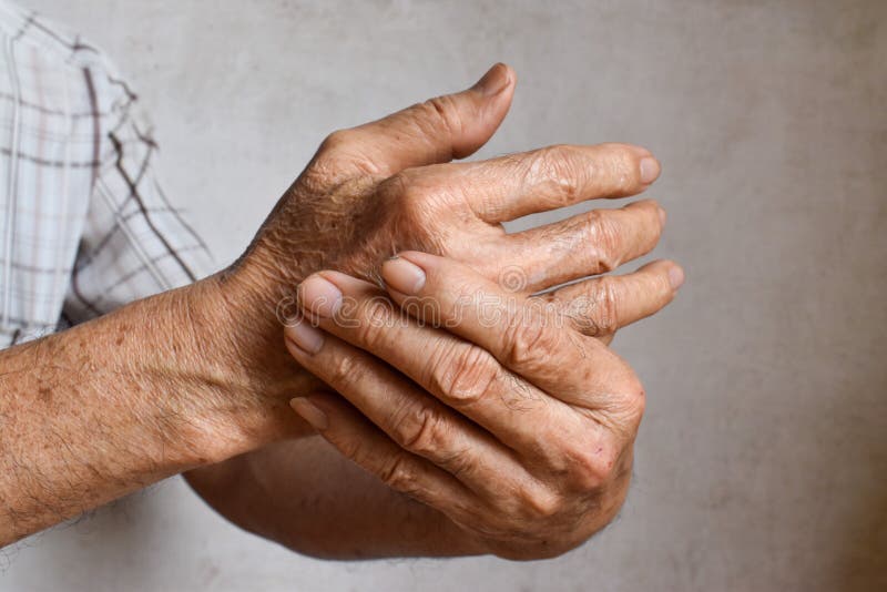 Asian Manâ€™s Fingers and Hand. Concept of Hand Pain, Arthritis and ...