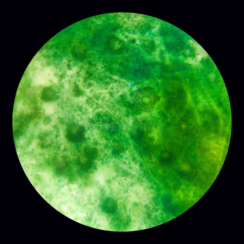 Aspergillus flavus stock image. Image of flavus, microscope - 380512271