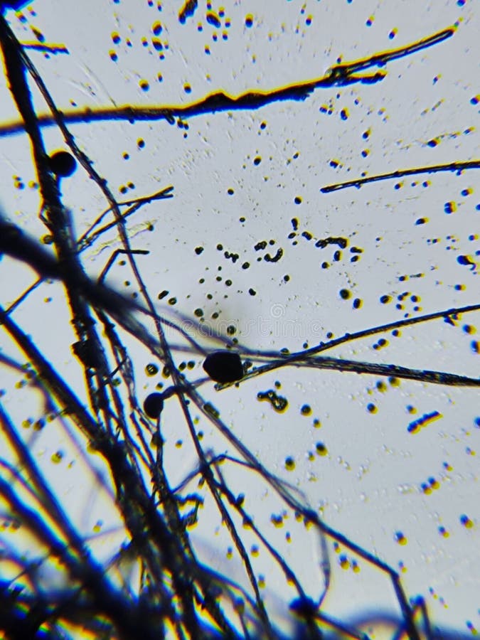 Aspergillus Genus Mold Under the Microscope Photo stock - Image of ...