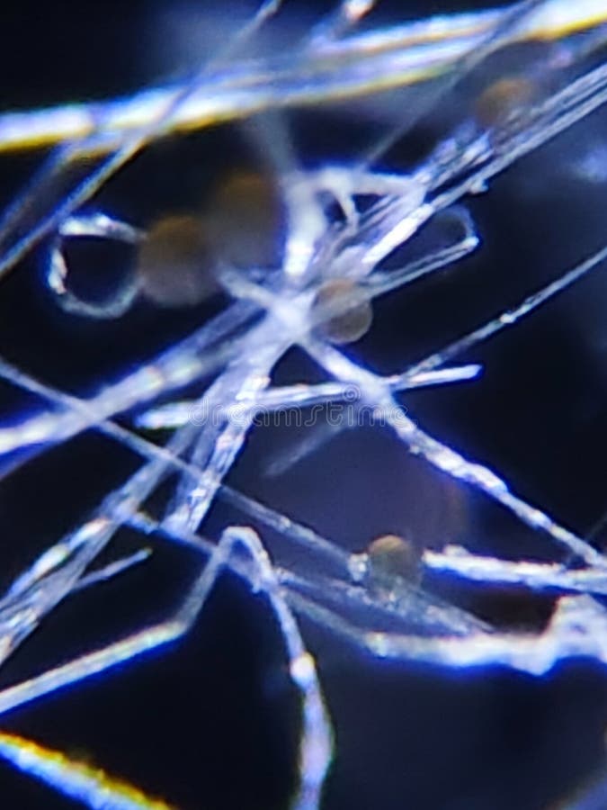 Aspergillus Genus Mold Under the Microscope Photo stock - Image du ...