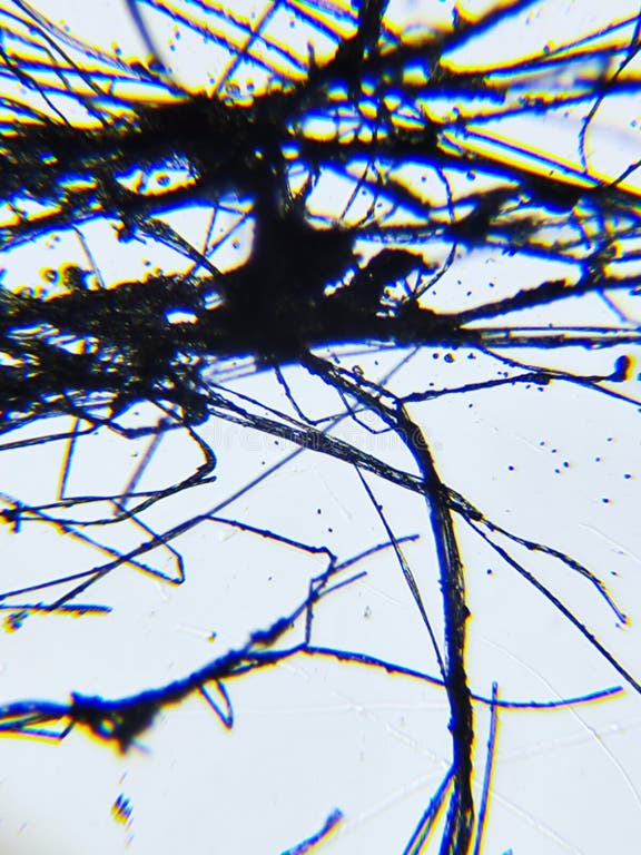 Aspergillus Genus Mold Under the Microscope Stock Image - Image of ...