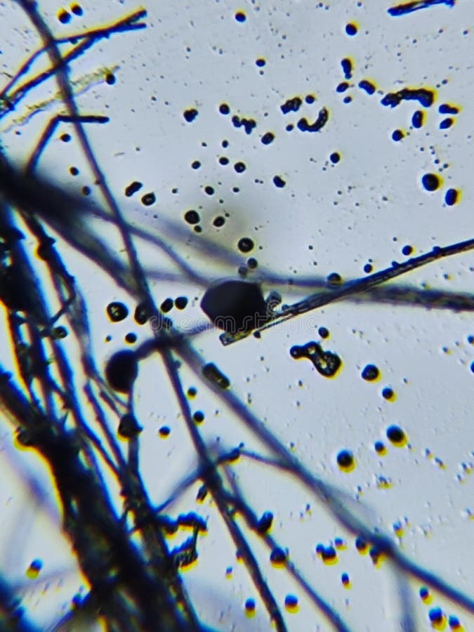 Aspergillus Genus Mold Under the Microscope Stock Image - Image of ...