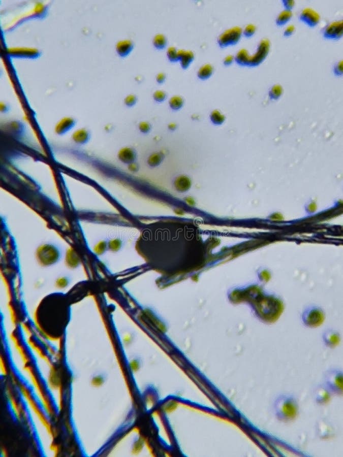 Aspergillus Genus Mold Under the Microscope Stock Image - Image of ...