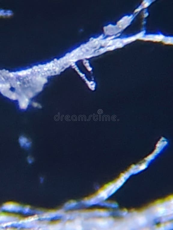 Aspergillus Genus Mold Under the Microscope Stock Photo - Image of ...