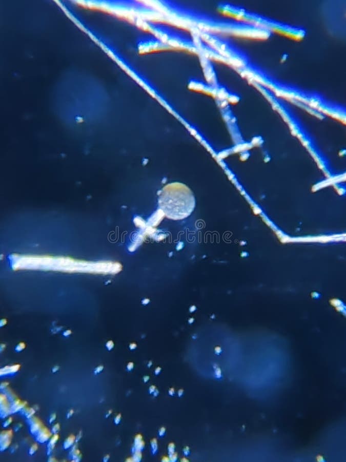 Aspergillus Genus Mold Under the Microscope Stock Photo - Image of ...