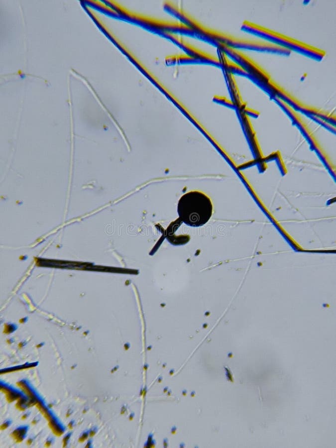Aspergillus Genus Mold Under the Microscope Stock Image - Image of ...