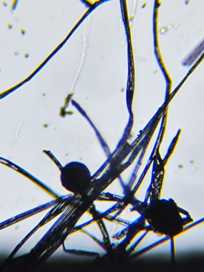 Aspergillus Genus Mold Under the Microscope Stock Photo - Image of ...