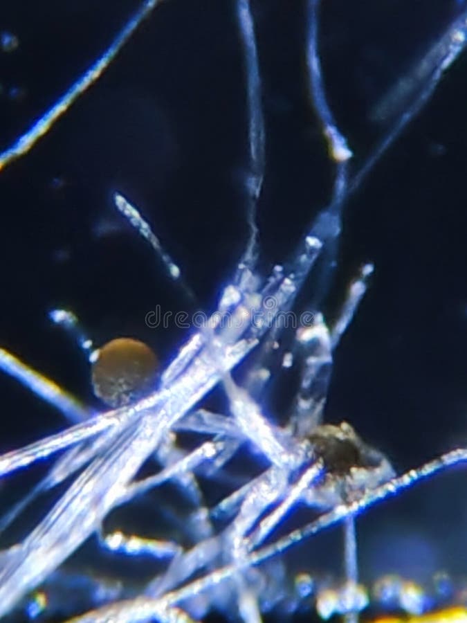 Aspergillus Genus Mold Under the Microscope Stock Photo - Image of ...