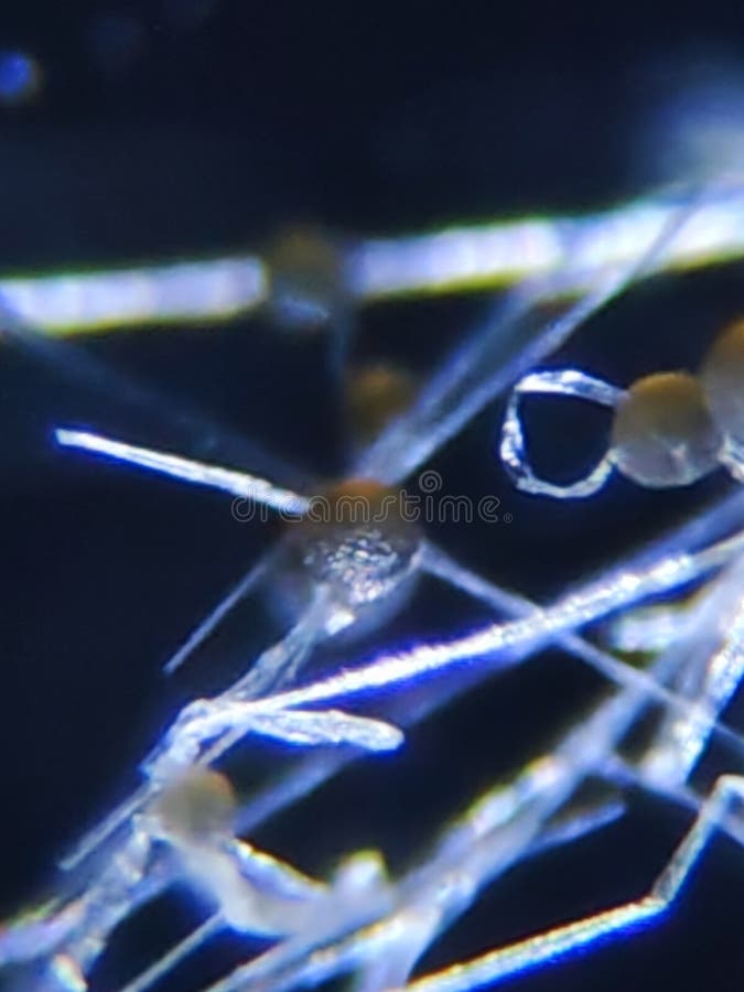 Aspergillus Genus Mold Under the Microscope Stock Image - Image of ...