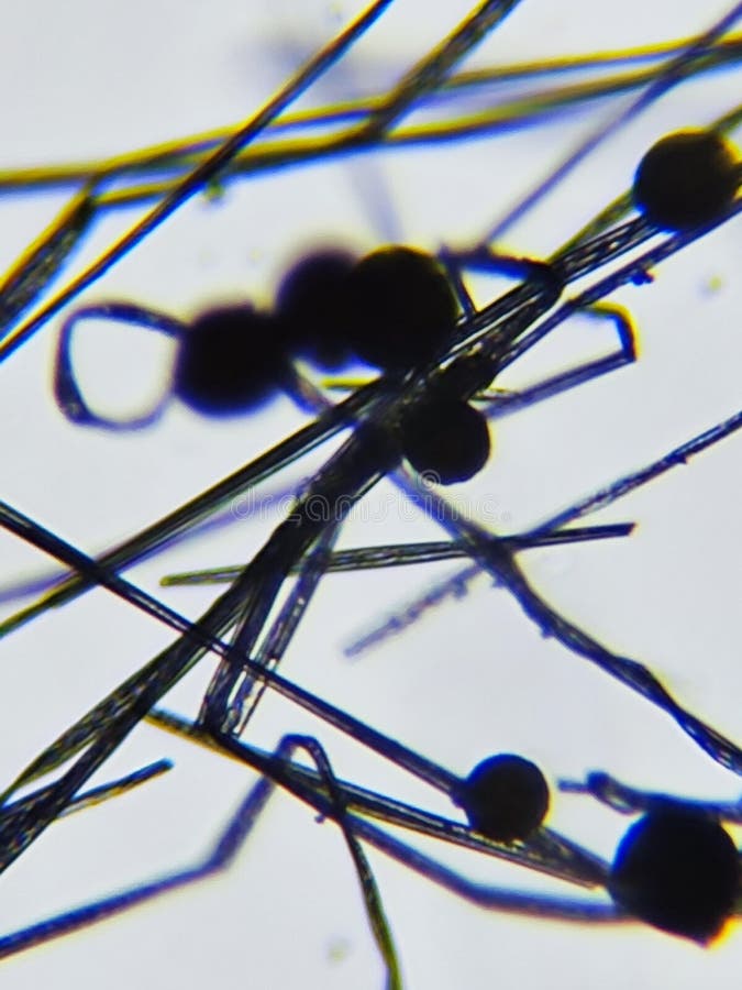 Aspergillus Genus Mold Under the Microscope Stock Image - Image of ...